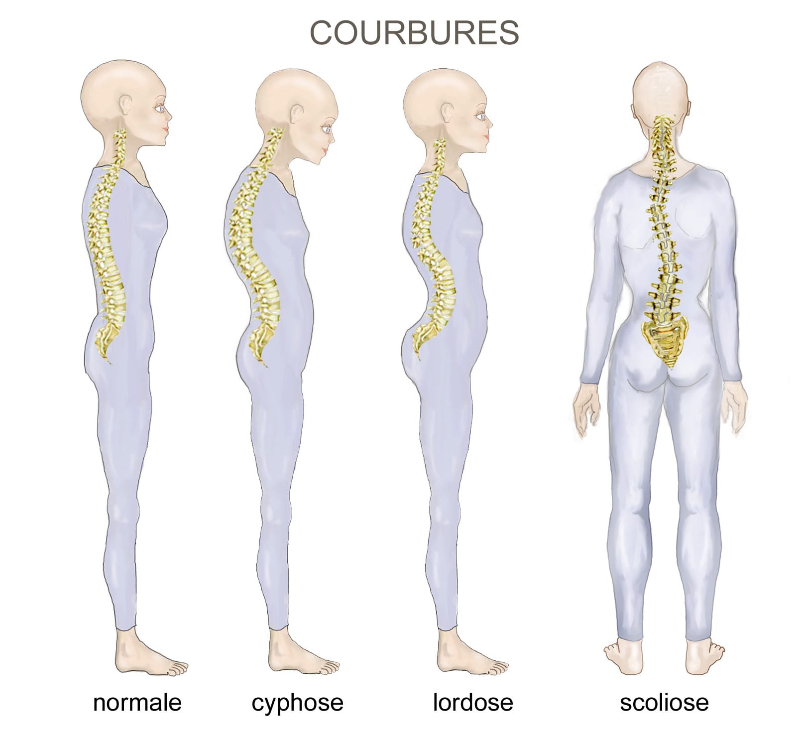 Intérêts de l'ostéopathie dans l'amélioration de la scoliose